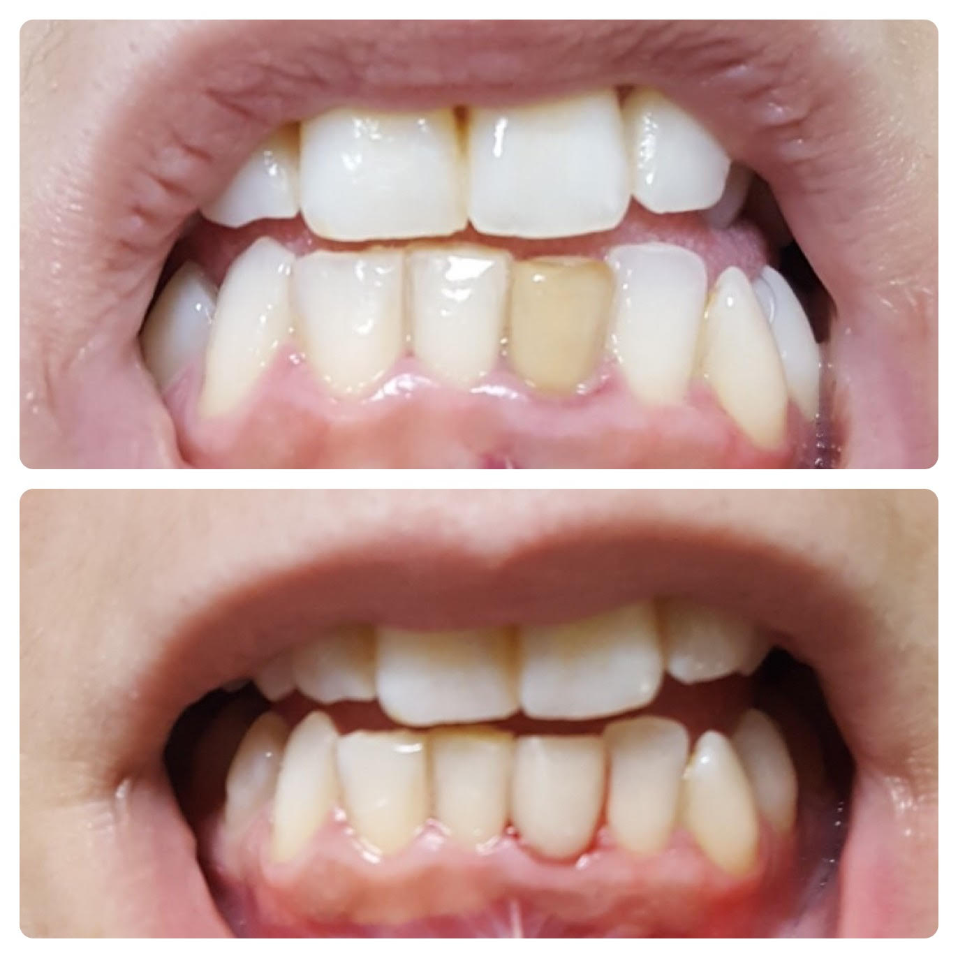 Όψεις – Diamond Smile